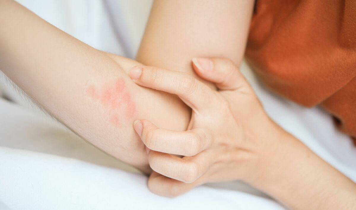 Prevention and Treatment of Minor Skin Infections | Family Health Diary